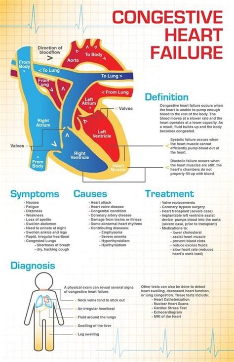 Infographic Heart Disease