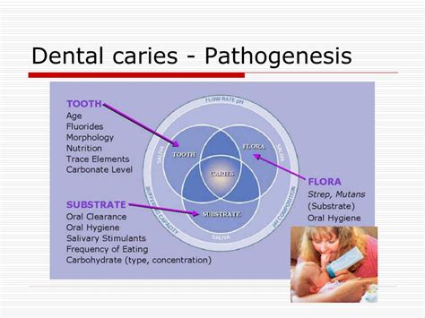 Ppt Oral Health Powerpoint Presentation Free Download Id 249961