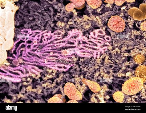 Smooth Endoplasmic Reticulum Electron Micrograph
