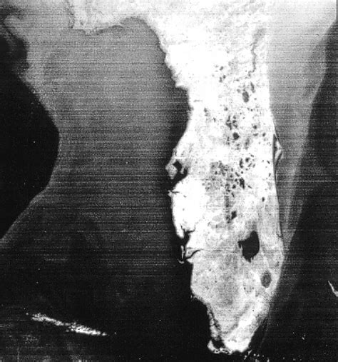 Using The Matlab Compare The Notch Filter And Optimum