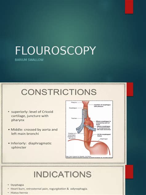 Flouroscopy Basrium Swallow Pdf