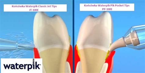 Waterpik Pik Pocket Tips Pp 100e Poddziąsłowe Końcówki Do Irygatorów