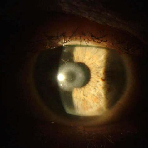 Close Up Image Of A Kamra Inlay Via Scanning Electron Microscope Download Scientific Diagram