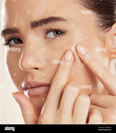 Portrait Hands And Pimple With A Woman Checking Or Examining Her Skin For Acne Problems In