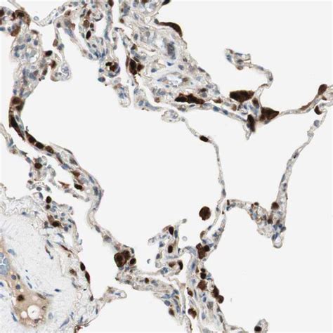 Rabbit Polyclonal Anti Lta4h Antibody Buy For Research Highly