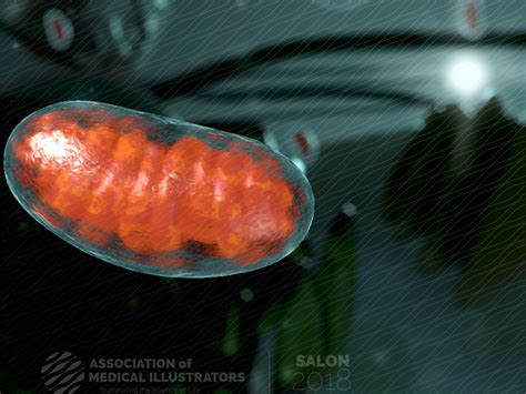 Phacoemulsification With Intraocular Lens Implantation Ami 2018 Meeting