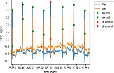 Figure 1 From Classification Of Arrhythmia In Time Series Ecg Signals Using Image Encoding And