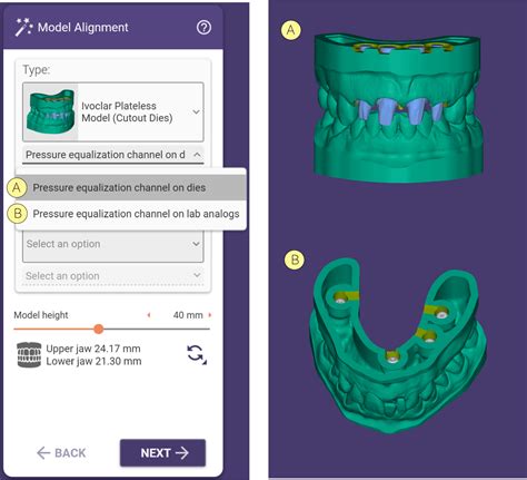 Model Creator Module Exocad