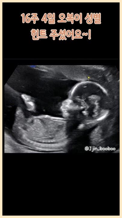 16주 오복이 성별이 성별따위 뭐든 좋아♥︎ 제발 건강하게만 태동이 뭔가요 저도 느끼고 싶어요~ 16주초음파 태아초음파 2차기형아검사 40대임신