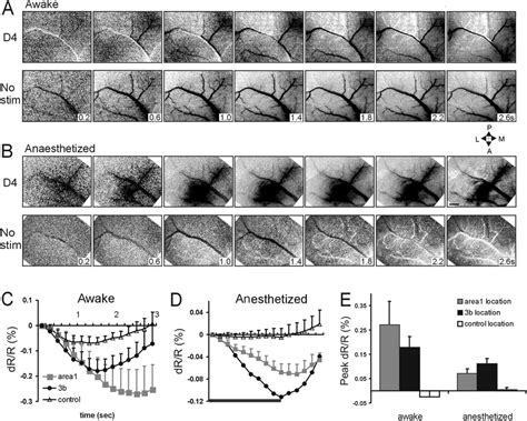 Temporal Development Of Optical Signal To Identical Vibrotactile