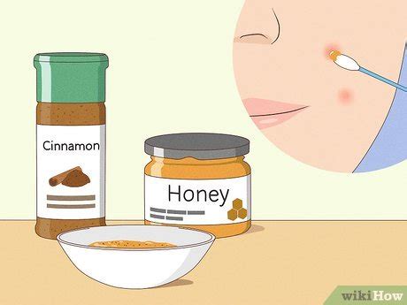 Ways To Reduce The Swelling And Redness Of Pimples WikiHow
