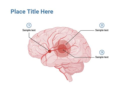 Brain Damage Layout BioRender Science Templates