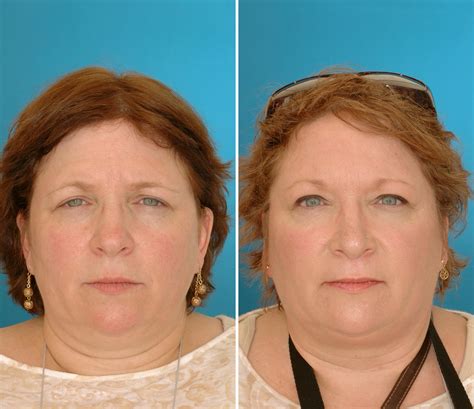 Smoking Wrinkles Twins