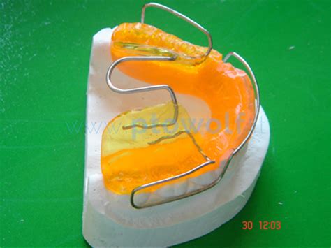 Bionator Ii Classe Progresso Tecnico Orthodontico