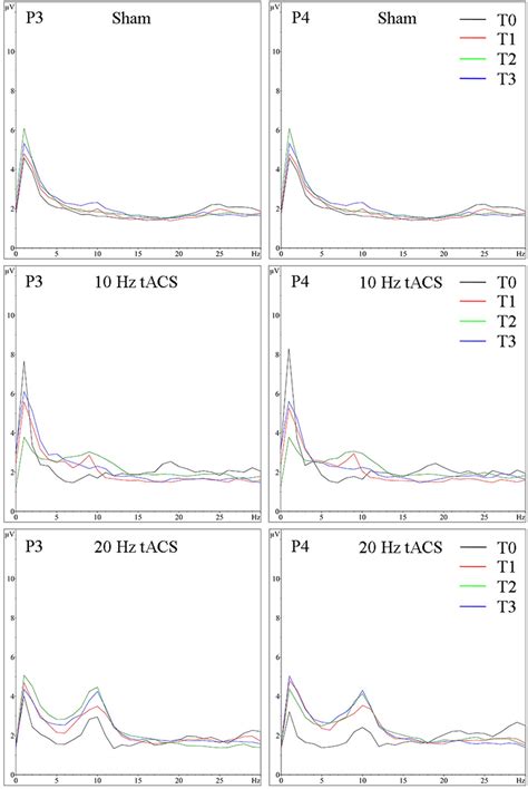Group Averaged EEG Activity In Rest With Eyes Open Frequency Spectrum Download Scientific