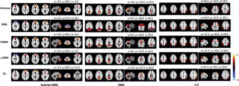 comparison of several components from five algorithms z‐maps