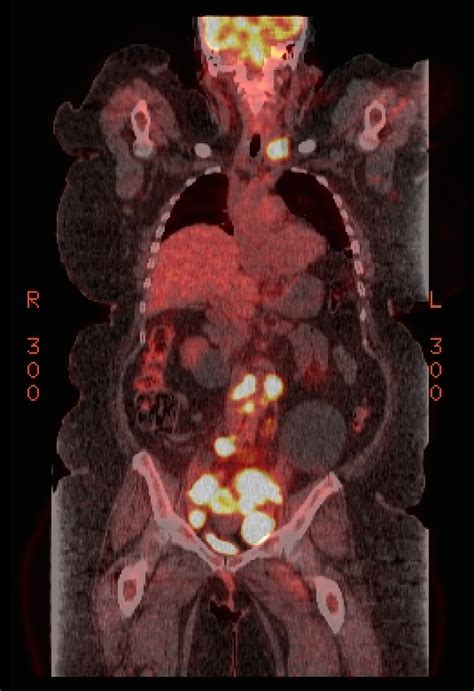 What Is Virchows Nuclear Medicine Imaging And Therapy Centre Of