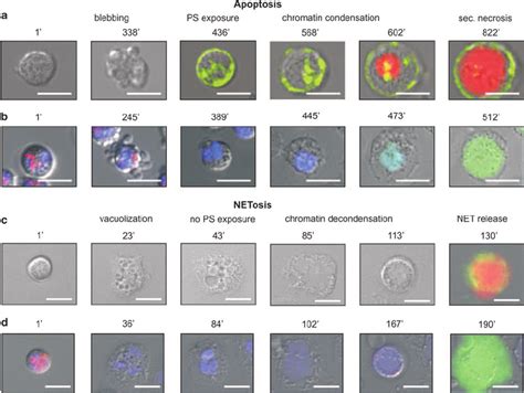 Live Cell Imaging Of Subcellular Events During Ex Vivo Neutrophil Download Scientific Diagram