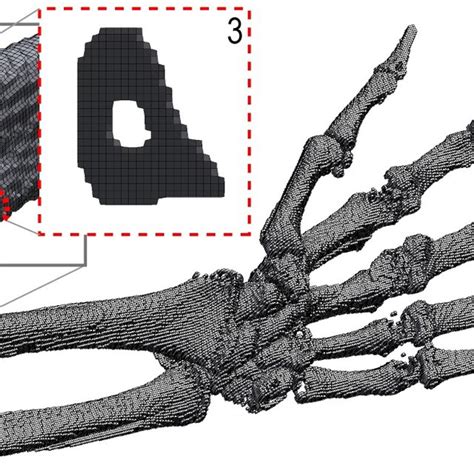 1 Voxel Model Of A Human Hand Extracted From A Ct Image 2 Detail
