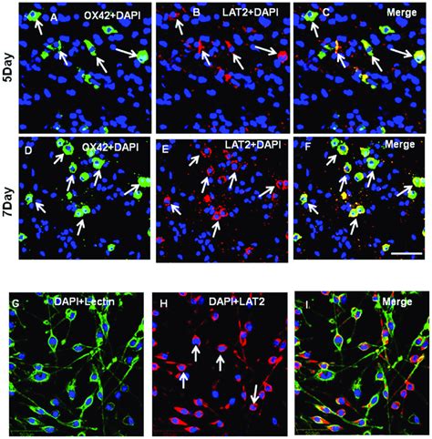 Lat2 Expression In Amc And Bv2 Microglia A F Confocal Images Showing