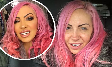 Jodie Marsh Before And After