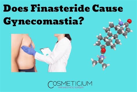 Does Finasteride Cause Gynecomastia Here Are Warning Signs