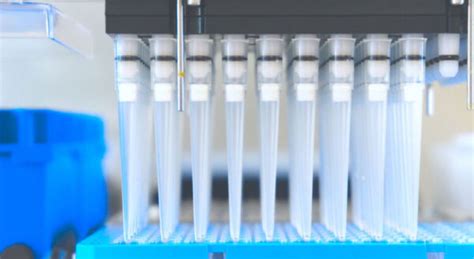 Ind Enabling Projects Axcelead