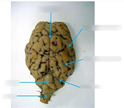 Sheep Brain Dorsal View Diagram Quizlet
