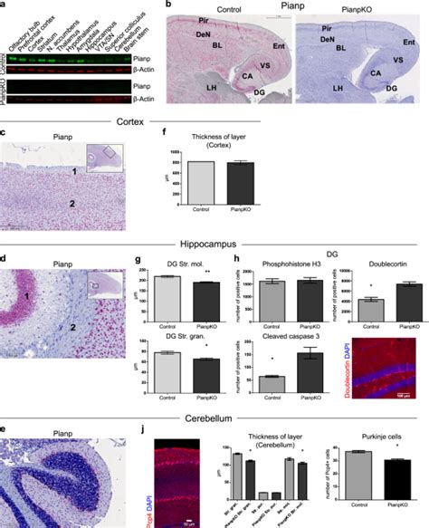 Pianp deficiency links GABAB receptor signaling and hippocampal and ...