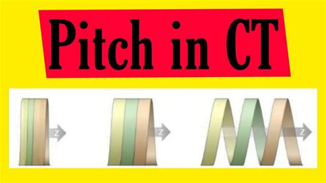Ct Pitch Formula At Raymond Eudy Blog