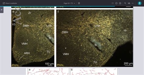 Pdf Projections From The Dorsomedial Division Of The Bed Nucleus Of The Stria Terminalis To