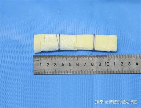 一天4例！再生定制骨手术在博鳌乐城常态化开展，为骨缺损患者带来先进治疗方案 知乎