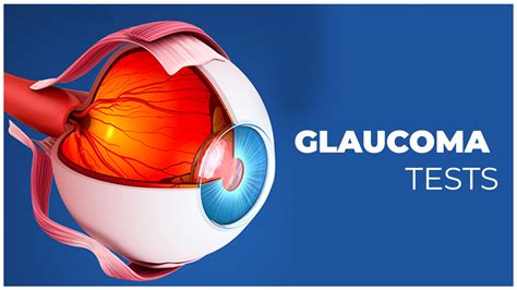 Glaucoma Tests
