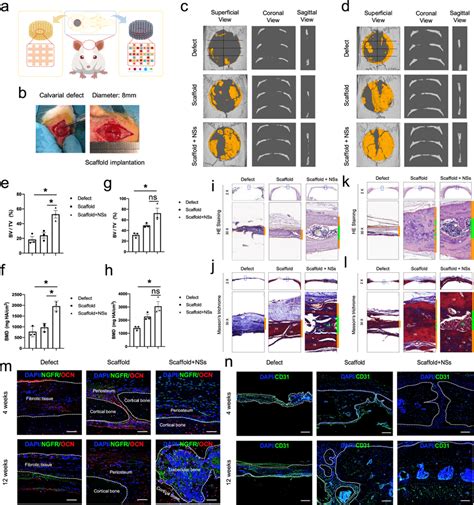 Transplantation Of The 3d Printed Hydrogel Scaffold With Nss Promotes Download Scientific