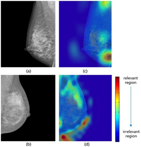 Cancers Free Full Text Automated Assessment Of Breast Positioning Quality In Screening