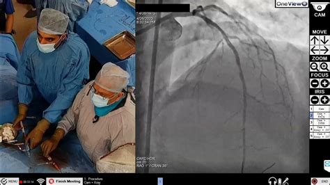 Staged Pci Of Lad Under Oct Guidance Youtube