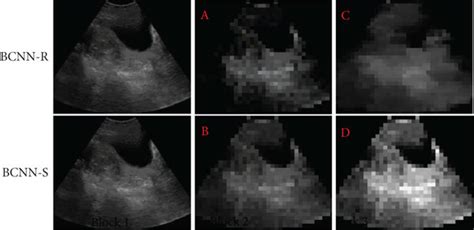 Bcnn R And Bcnn S Feature Images A The Activation Region Shown In