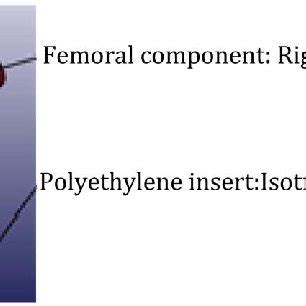 Finite Element Model Download Scientific Diagram