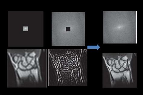 K Space And Parallel Imaging