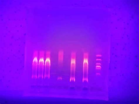 236 Questions With Answers In Bacterial Dna Science Topic