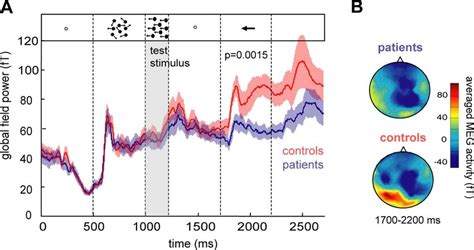 Time Course Of Gfp And Spatial Distribution Of The Meg Responses A