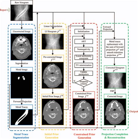 Figure 1 From A Hybrid Metal Artifact Reduction Algorithm For X Ray Ct Semantic Scholar