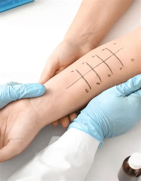 Allergy Testing For Tampa And Brandon Fl Allergy Asthma And Immunology Associates Allergy