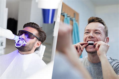 Home Bleaching Or In Office Bleaching Dentamile