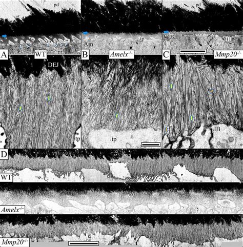fib sem micrographs of recently formed initial enamel level 1 2 in wt
