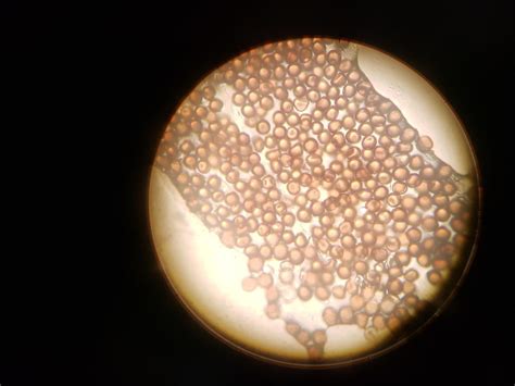 Leaf Rust On Bermudagrass Tattnall County Extension