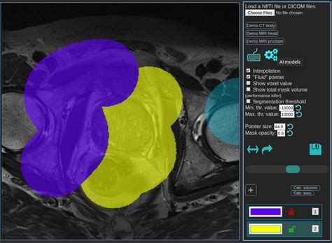 I Am Creating A Free Web Based Annotation Tool With Ai For Volumetry On