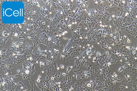 Hacat Luc 人永生化表皮细胞荧光素酶标记 原代细胞 Str细胞 细胞培养基 镜像绮点生物