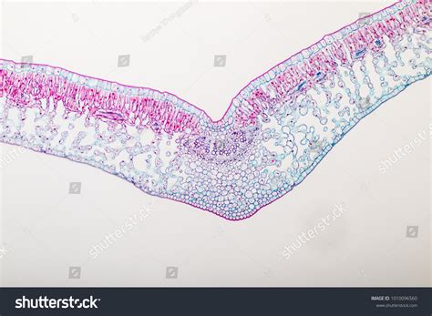 Cross Section Of A Leaf Microscope Cranberry Leaf Cross Section Under