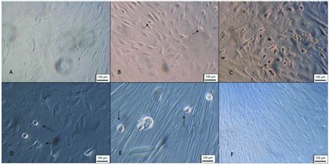 Differentiation In Schwann Cells From Neural Precursors A Cells 4